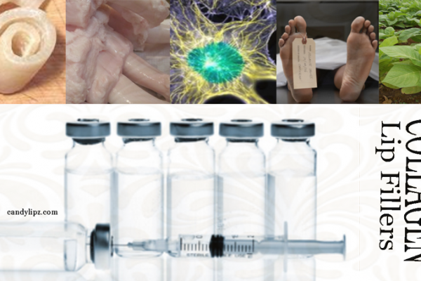 Collagen Lip Injections Archives - CandyLipz